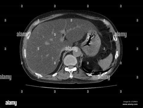 Body scan fat Fotos und Bildmaterial in hoher Auflösung Alamy
