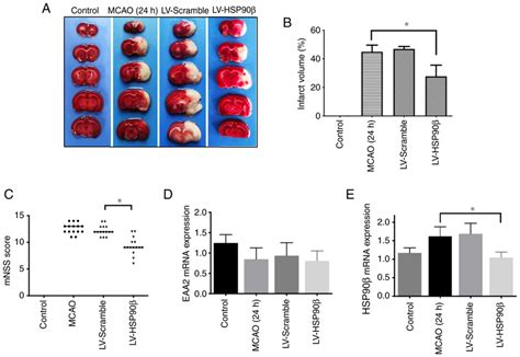 inhibition of HSP90β expression exhibits a neuroprotective effect in
