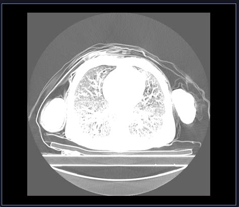 Why Is The Voi Information Not The Default For Dicom Files Parsed Locally The Modality Is Ct