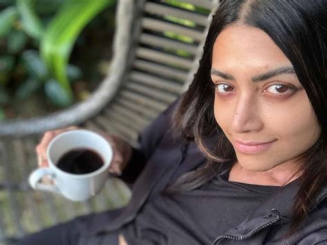 Im Losing Colour Mamta Mohandas Reveals Being Diagnosed With Vitiligo