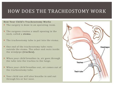 PPT Tracheostomy Teaching Guidelines For Patients Families PowerPoint