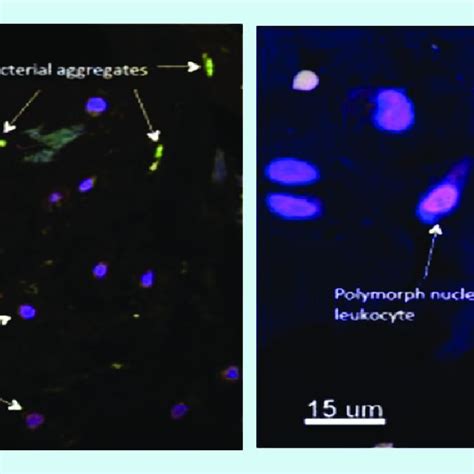Microscopic Tissue Sample Stained In The Flourescence In Situ