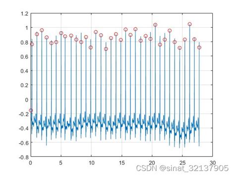 利用matlab读取physionet数据库的具体步骤（一）wfdb App Toolbox 0 10 0zip Csdn博客