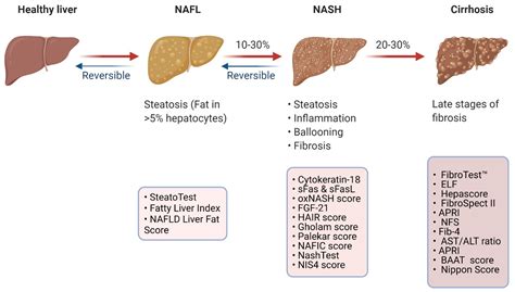 Liver Disease Progression Chart
