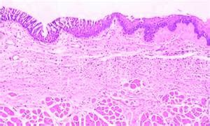 Arrayit Tissue Microarrays For Basic And Cancer Research Life Sciences Clinical And