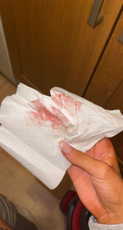 What Does Implantation Bleeding Look Like On A Pad