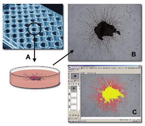 Three Dimensional Angiogenesis Assay In Vitro During In Vitro Culture
