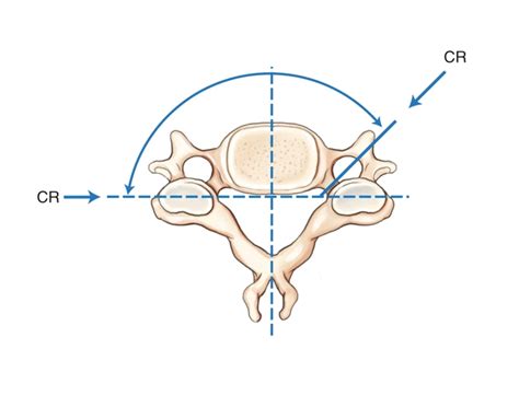 Cervical Vertebrae Zygapophyseal Joints Quiz