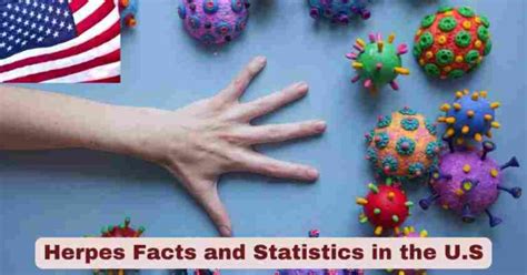 Herpes Facts And Statistics In The U S 2025 The Global Statistics