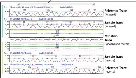 3 Graphical Display Of An Identified Mutation The Mutation Is Shown