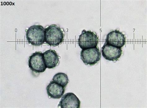 Schroeteria Delastrina Plant Parasites Of Europe