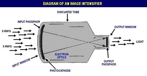 Fluoroscopy Lover Component Of Fluoroscopy