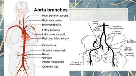 TR Angio Abdomen Hepatica Renalis Pptx