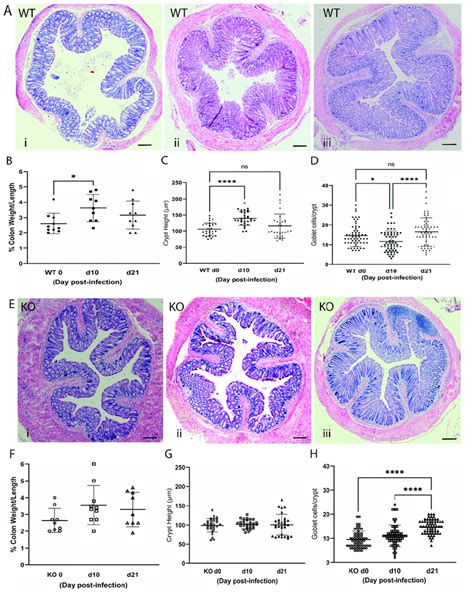 Infection With Citrobacter Rodentium Caused Infectious Colitis In