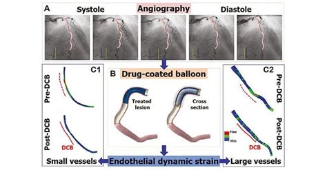 angiography based computational modeling for in vivo assessment of