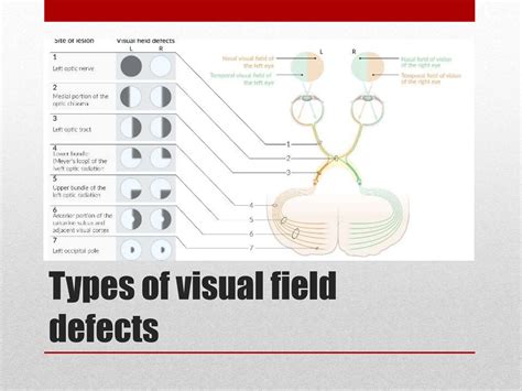 Cranial Nerves Examination Cranial Nerve Examination Frequently Appears In OSCEs PPT
