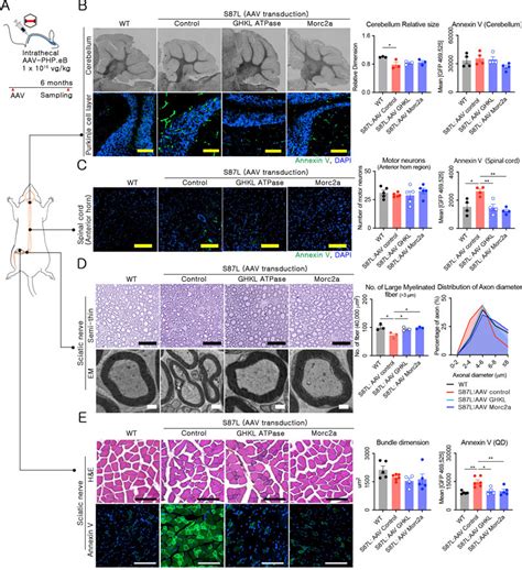 희귀신경질환 유전자 치료법 세계 최초 개발 연구성과 연구 서울대학교