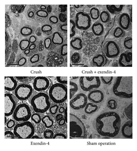 Electron Microscopic Findings Of The Sciatic Nerve Thin Sections