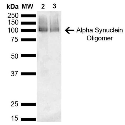 Alpha Synuclein Monoclonal Antibody 3c11 Fitc Ma5 45838