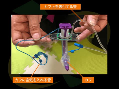 気管切開の基礎（3）〜今さら聞けない在宅医療の基礎知識 Vol 2〜｜なんぴろ〜 医 輝優会かがやきクリニック 院長 南條浩輝〜【在宅医療