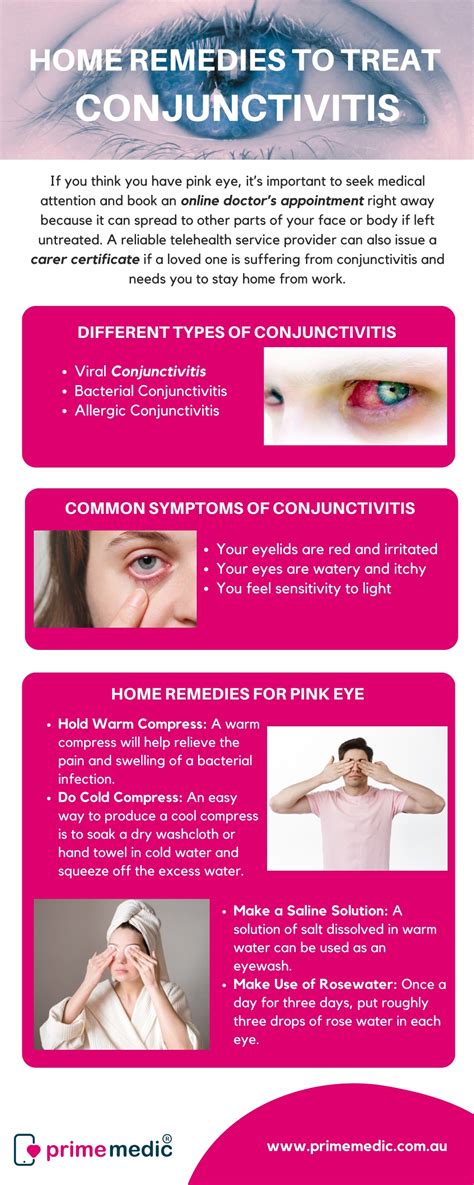 Ppt Home Remedies To Treat Conjunctivitis Powerpoint Presentation