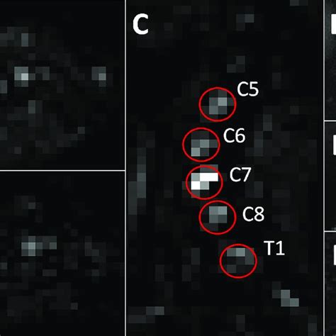 Diffusion And Non Diffusion Weighted Images And Segmentation A