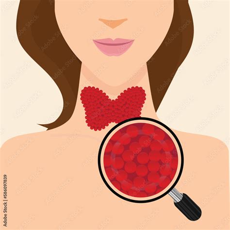 Thyroid Gland Vector Illustration Thyroid Gland And Trachea Shwn On A
