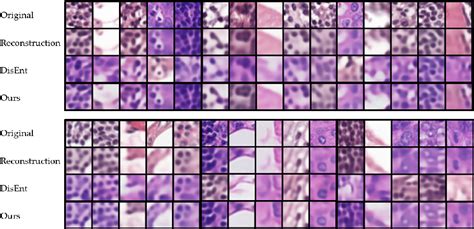 Figure From Interpretable Approach To Discover And Remove Hidden