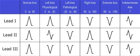 Mastering Axis Determination Part 6