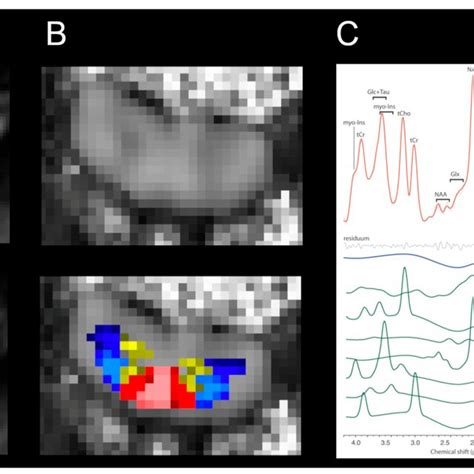 Quantitative Mri Qmri Markers Derived Using Various Qmri Methods