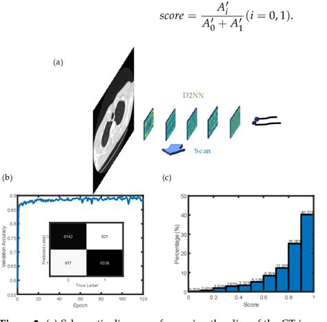 Figure 2 From Pulmonary Nodule Detection And Classification Using All