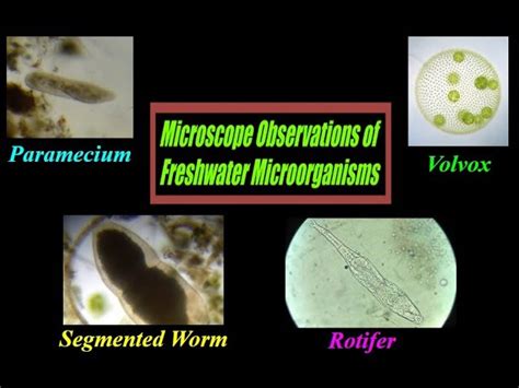 Microorganisms In Pond Water Under Microscope