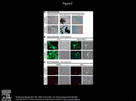 Comparative Study Of Human Eutopic And Ectopic Endometrial Mesenchymal