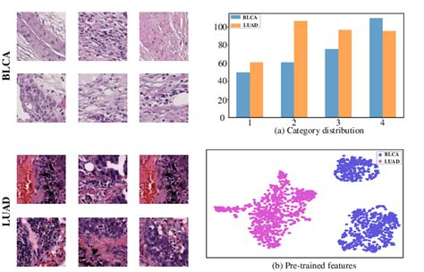 An Example Of Pathology Images With Distribution Shift The Left Shows