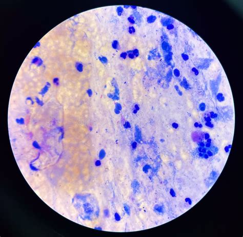 Red Cell On Center Mycobacterium Tuberculosis Bacteria Stock Image