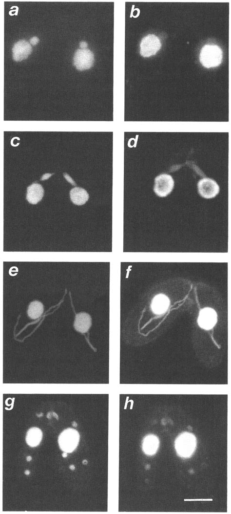 Micronucleus And Macronucleus