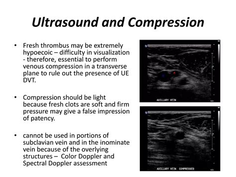 Venous Doppler Upper Limb Pptx