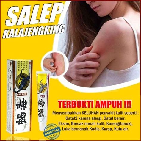 Jual Salep Scabies Scorpion Original Salep Kulit Scorpion Salep Gatal