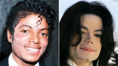 Michael Jackson Before And After Plastic Surgery And Transformation