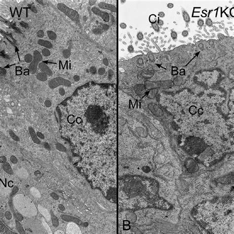 Electron Microscopy Of Efferent Ductule Cilia A Higher Magnification