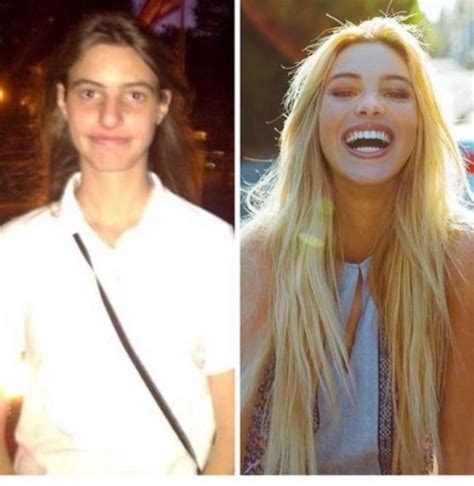 Lele Pons Y Su Radical Cambio Físico