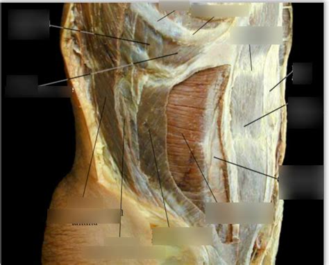 Abdomen 2 Diagram Quizlet