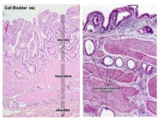 The Biliary Tract Pptx