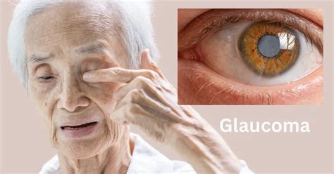 Glaucoma Eye Disease Causes Diagnosis And Treatment