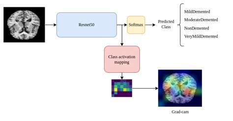 MRI Image Classifier For Alzheimers Disease Albertos Homepage