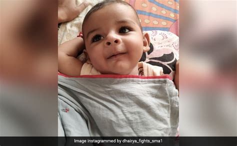Human Born With One Eye