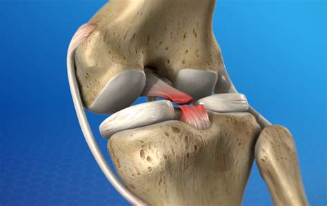 Ligament Knee Surgery