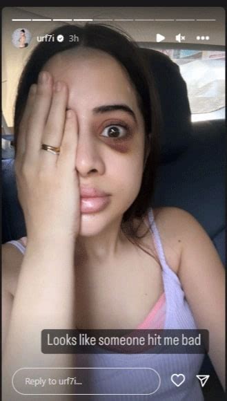 Urfi Javed Shocks Her Fans Again Bares It All In New Sizzling Video People News Zee News