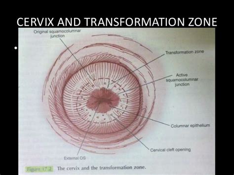 Cervix And Transformation Zone Figure 17 1 17 2 And 17 3 Mermaid
