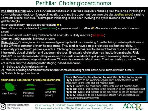 Dr Siddharth Tewari On Linkedin Radiology Aocr Meded Radres